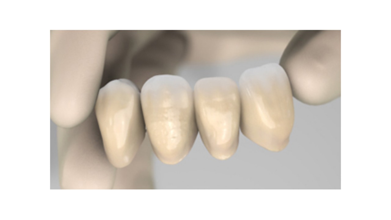 Materiales provisionales